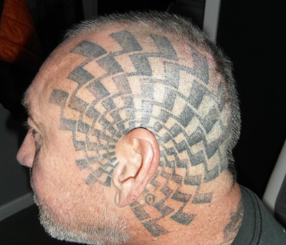 Portfolio - Shattered Ink Laser Tattoo Removal